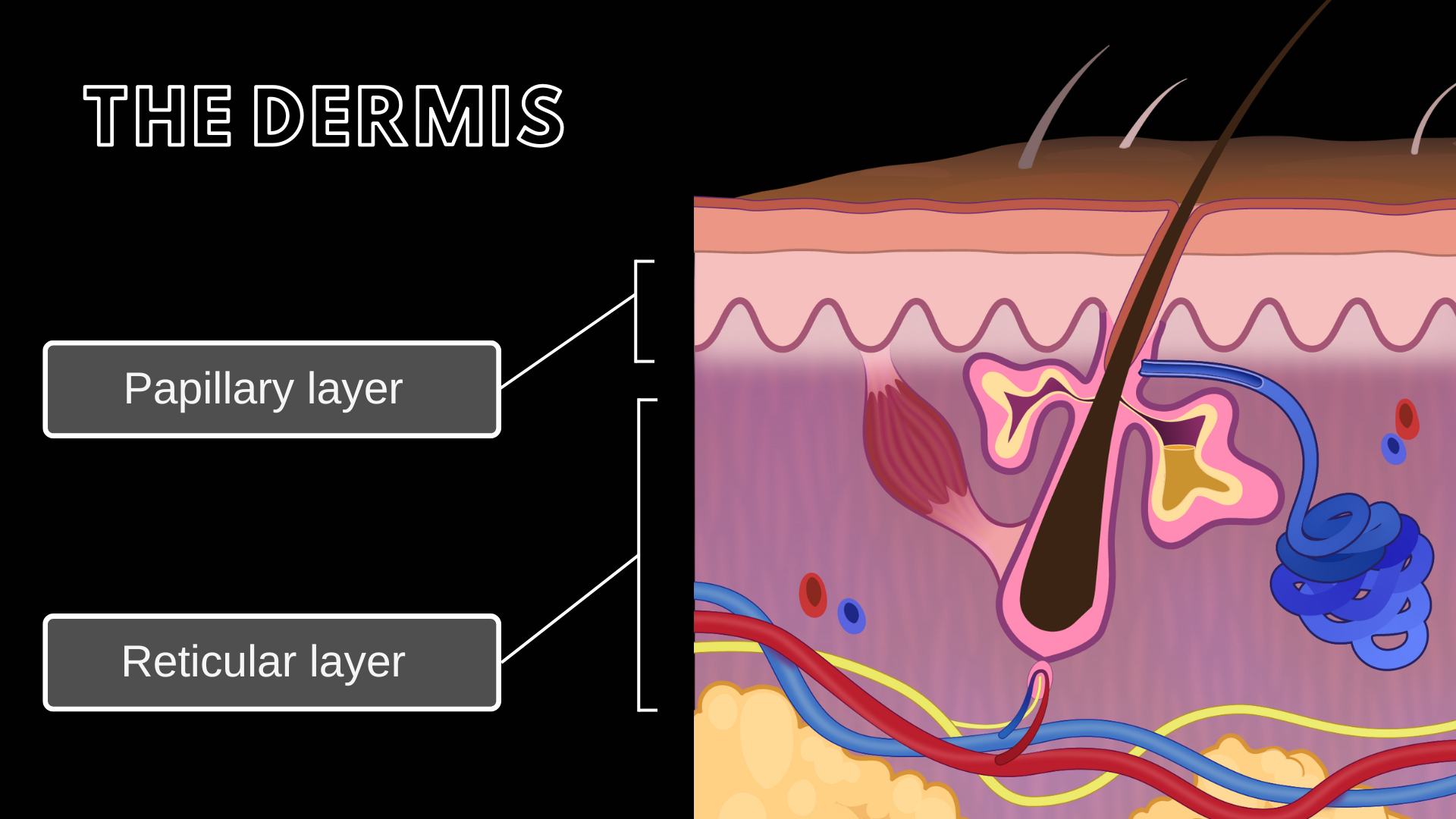 The Integument and Eczema | BodyViz Brain Builder
